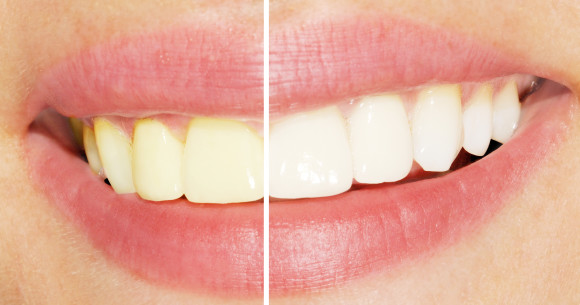 Cosmetic – Todd Bell, DDS