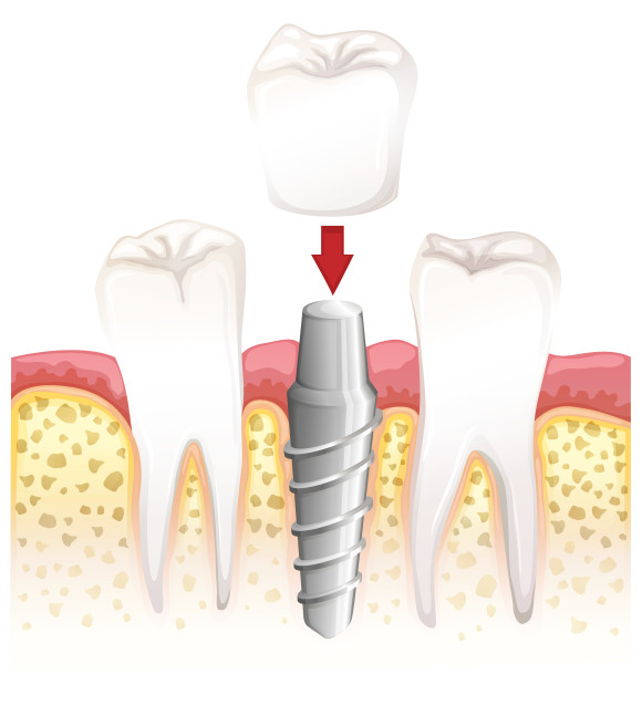 Cosmetic – Todd Bell, DDS